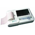 2D Echo/Tread Mill Test (TMT) Scan in Hyderabad - Lucid Medical Diagnostics